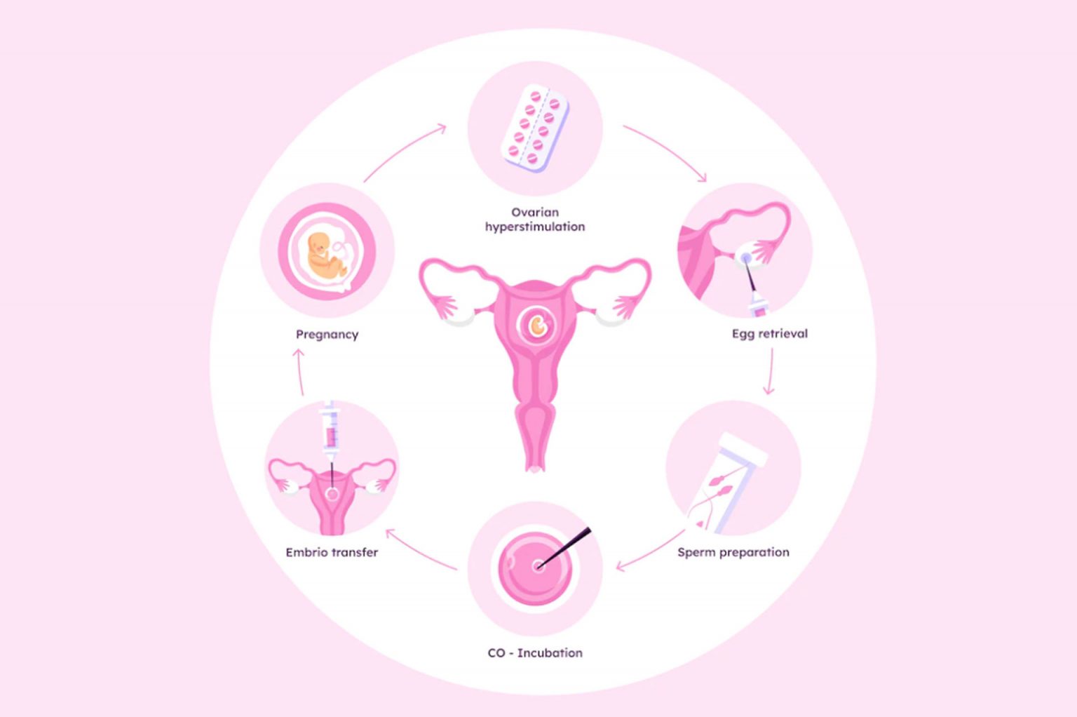 Comprehensive Ivf Process Guide Start To Finish
