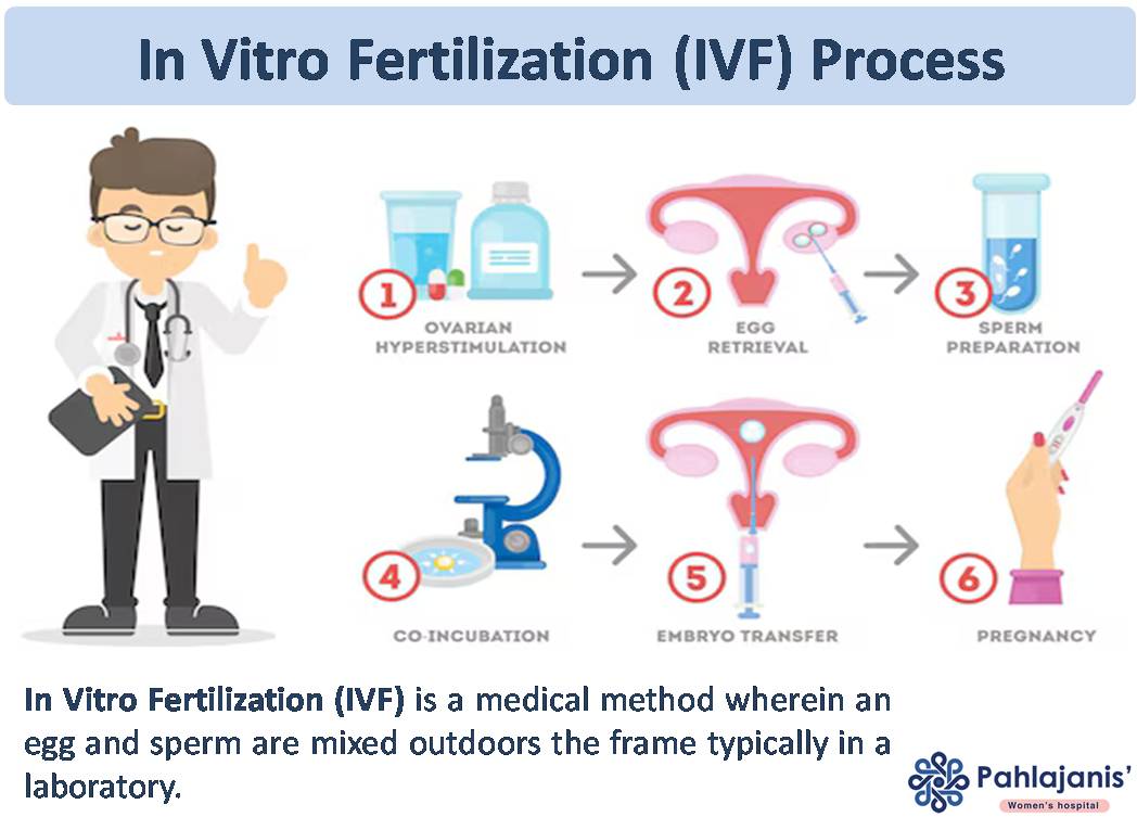 Comprehensive IVF Process Guide: Start to Finish